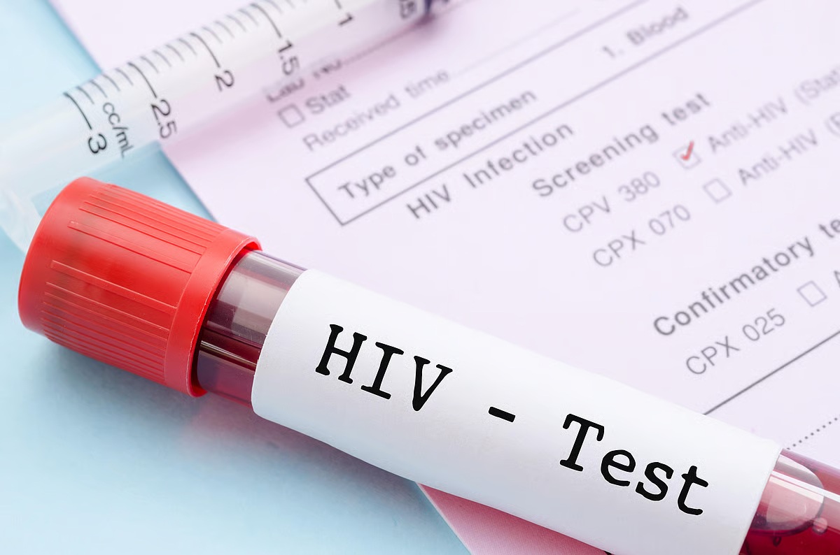 HIV Treatment Antiretroviral Therapy Explained | The MES Times